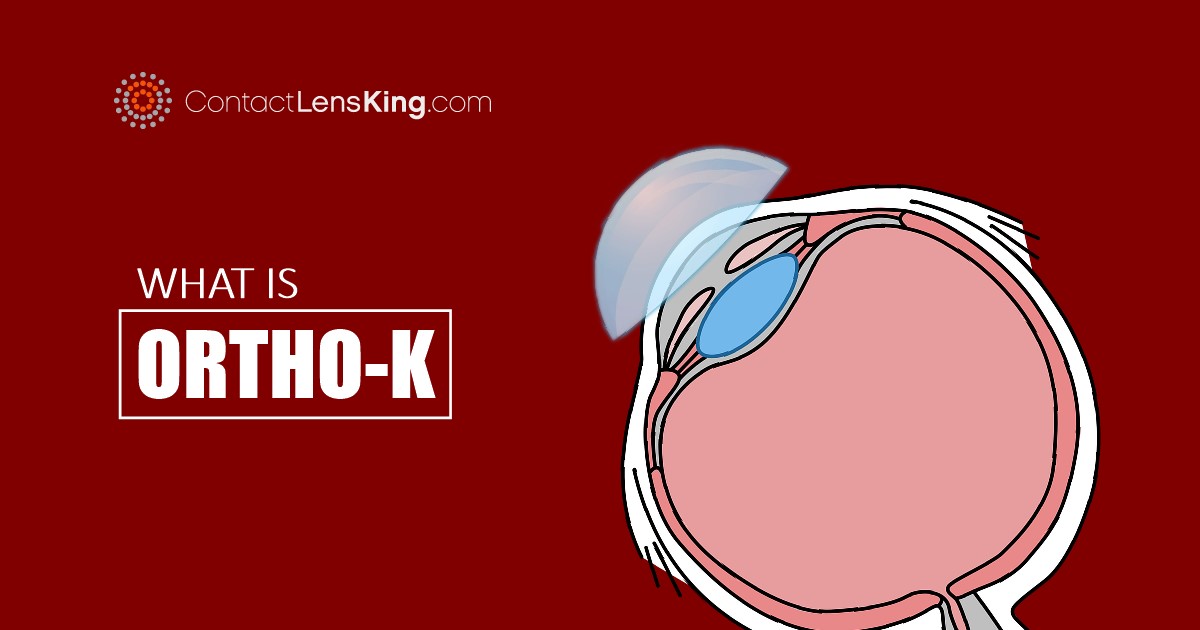 What is Orthokeratology or Ortho-k? - Contact Lens King Blog