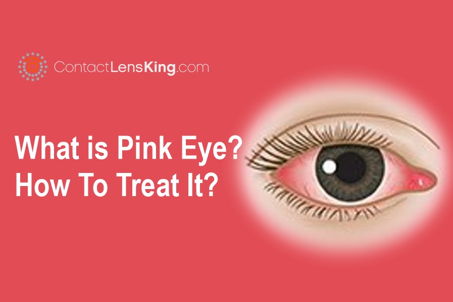 What is Pink Eye and How is it treated - Contact Lens King Blog