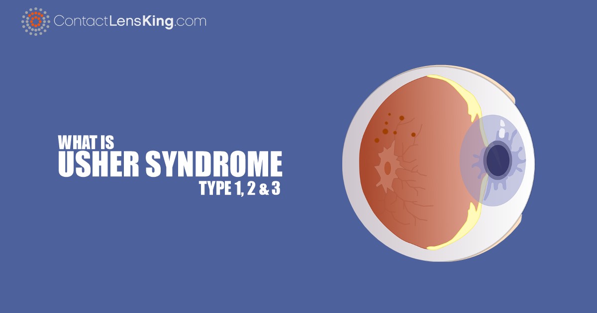 What is Usher Syndrome Type 1, 2 and 3 - Contact Lens King Blog
